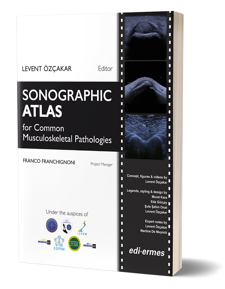 ENGLISH EDITIONS: Sonographic Atlas for Common Musculoskeletal Pathologies