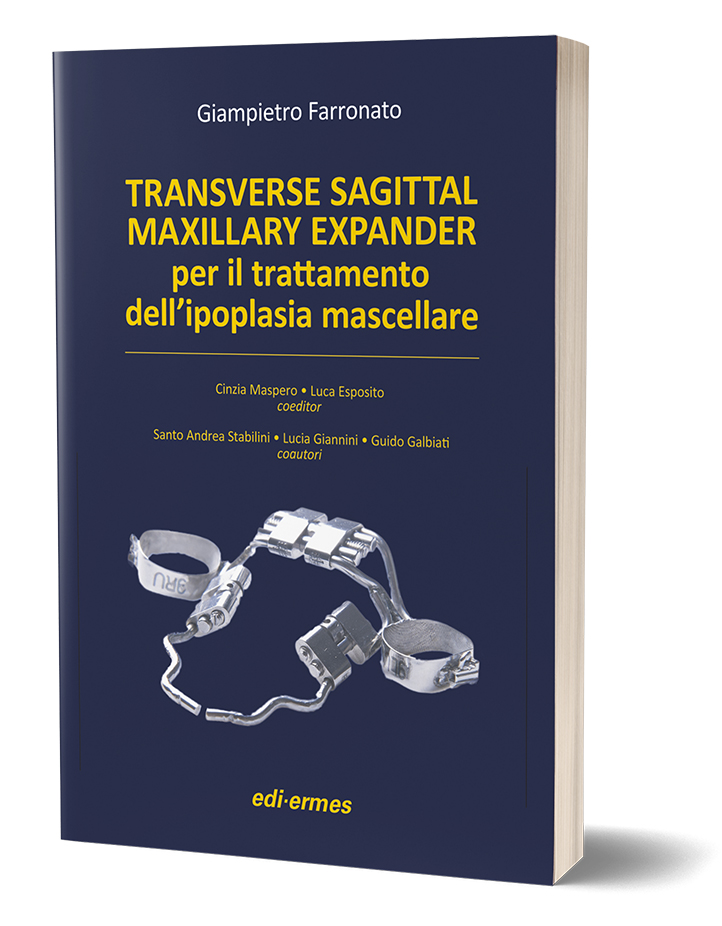 CATALOGO LIBRI: Transverse Sagittal Maxillary Expander per il ...
